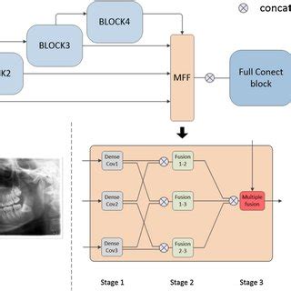 Convolutional Neural Networks With Multiple Feature Fusion MFF Module Download Scientific