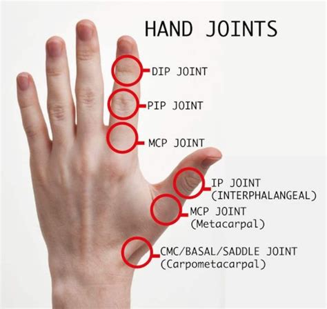 Arthritis Finger Mcp Joints Splint Brass Or Sterling Silver Etsy