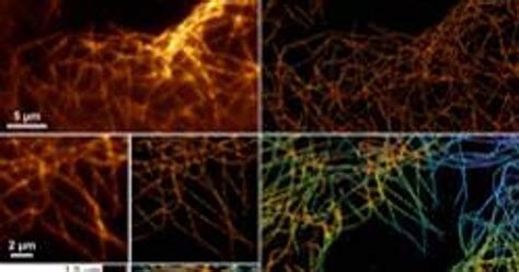 Molecular Devices Introduces Real Time Super Resolution System For Metamorph Software