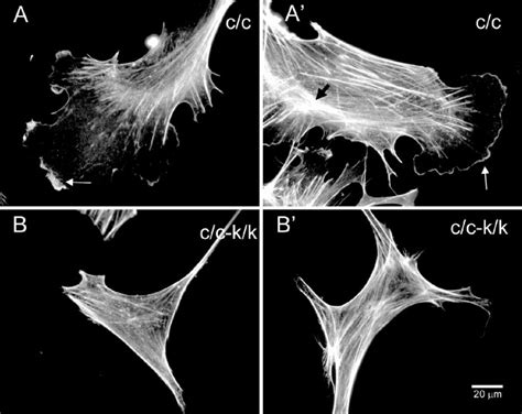 F Actin Distribution In Rac1 Null Cells F Actin Was Detected With Download Scientific Diagram