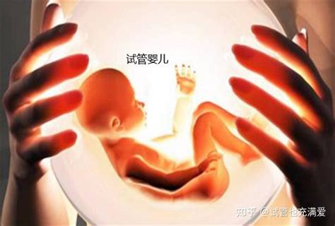 关于试管婴儿的基础知识 知乎