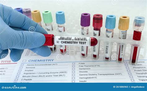 Requisition Report Stock Footage And Videos 28 Stock Videos