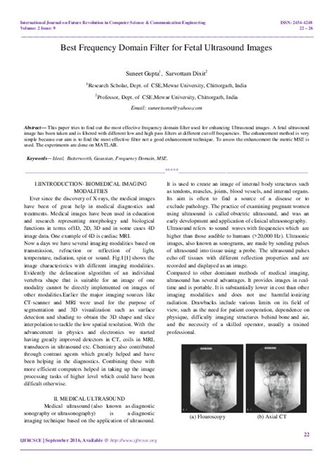 Pdf Best Frequency Domain Filter For Fetal Ultrasound Images