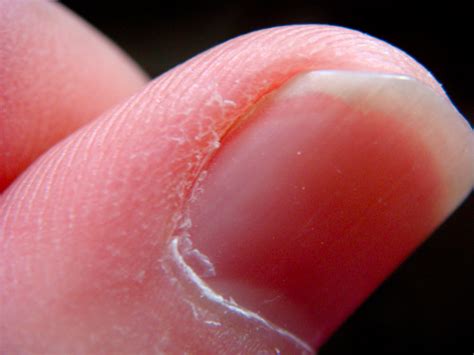 4 Health Secrets Hiding In Your Nails Business Insider