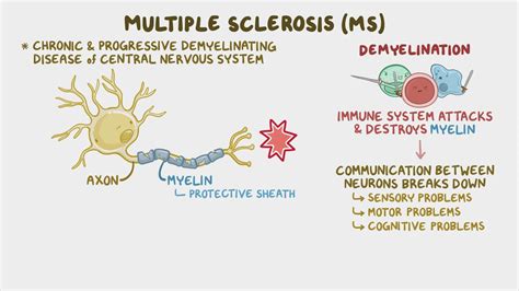 Video Disease Modifying Therapy For Multiple Sclerosis Nursing