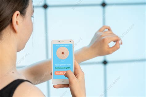 Woman Using Smartphone App To Check Moles Stock Image F