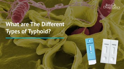 What Are The Different Types Of Typhoid Reszonics