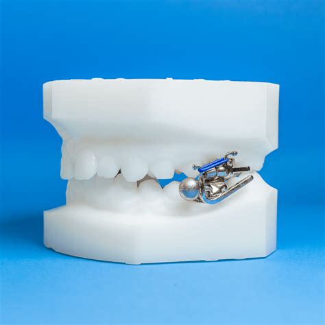 Mara Ordont Orthodontic Appliance Lab