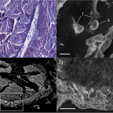 Micrographs Of Hemocytes In The Interstitial Tissues Of The Download Scientific Diagram