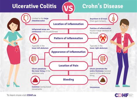 Ulcerative Colitis Stool Appearance