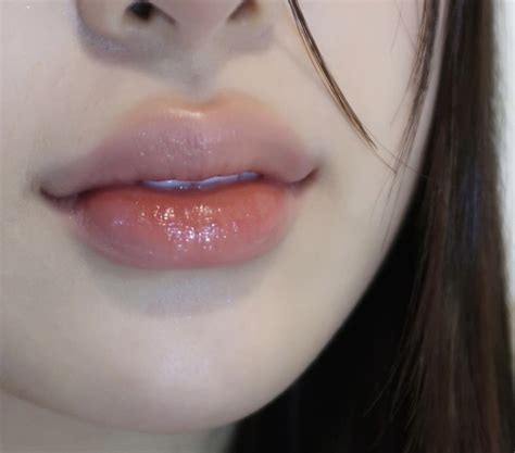 병원질문 입꼬리수술은 흉터가 강남언니 1등 성형수술and피부시술 정보앱