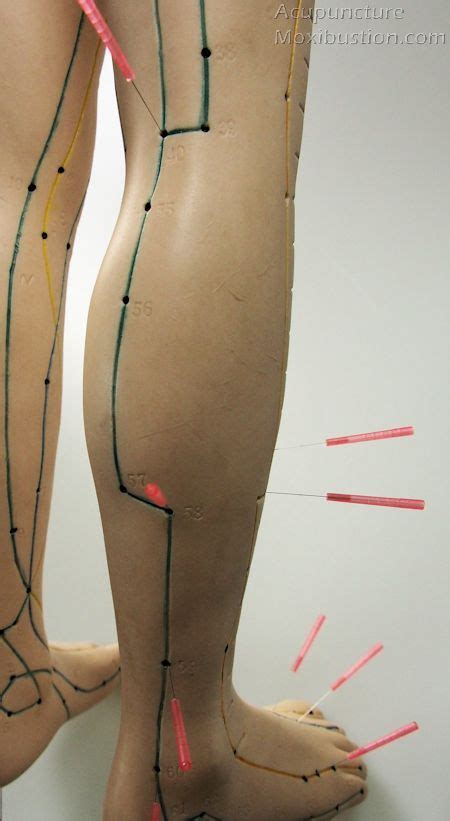 Acupuncture Points Used For Sciatica Artofit