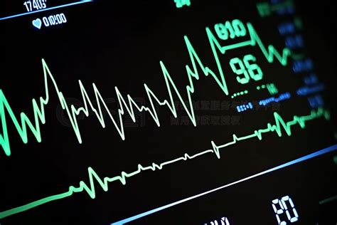 监护设备ai数字艺术 监护设备科技医疗心电图屏幕心率波形商业照片 Ai图片免费下载png格式1344像素编号71361231 千图网