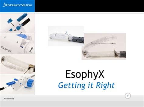 Overview Of Endoscopic Gastric Fundoplication Ppt Digestive Disorders Diseases And Conditions