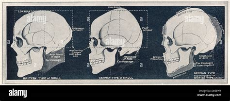 Types Of Skull Shapes At Ben Lackey Blog