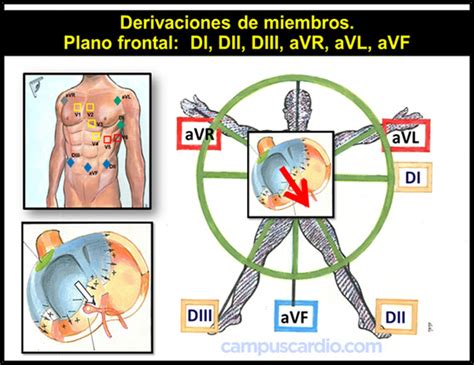 Di Dii Diii Electrocardiograma Electrocardiograma Convencional Pdf