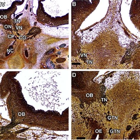 Bielchowsky Stained Cross Section Of Human Embryo A D 25 Mm Download Scientific Diagram