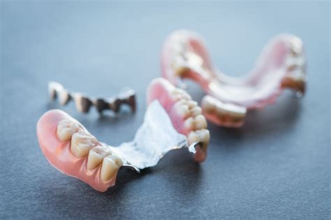 Explore The Temporary Dental Bridging The Fit Care