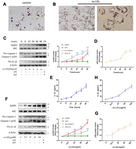 K63 Ubiquitin Chains Target Nlrp3 Inflammasome For Autophagic Degradation In Ox Ldl Stimulated