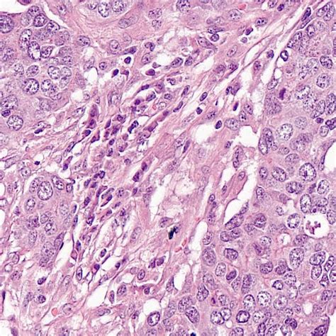 Yolov11 Object Detection Dataset And Pre Trained Model By Coco