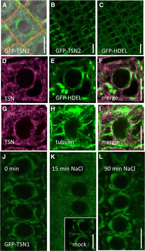 Tsn Subcellular Localization In Root Epidermal Cells All Micrographs