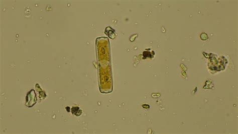 What Is This Thing I Found In Some Moss Magnification Was At 100x R