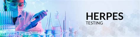 Herpes Test London Herpes Blood Testing STD Check Clinic