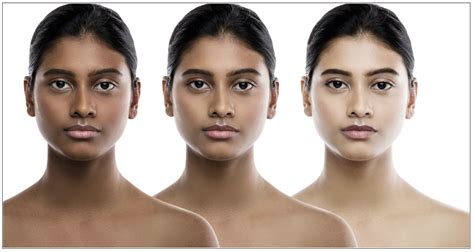 Mercury Poisoning Skin Whitening Shop