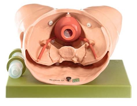 Bladder Phantom For Endoscopy