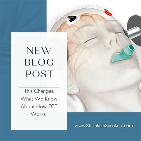 This Changes What We Know About How ECT Works Shrinks In Sneakers