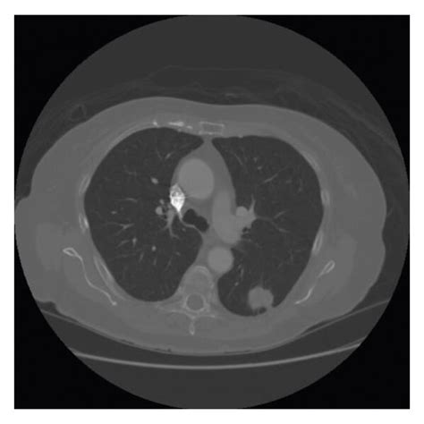 A Original Dicom Image B Processed Dicom Image Download