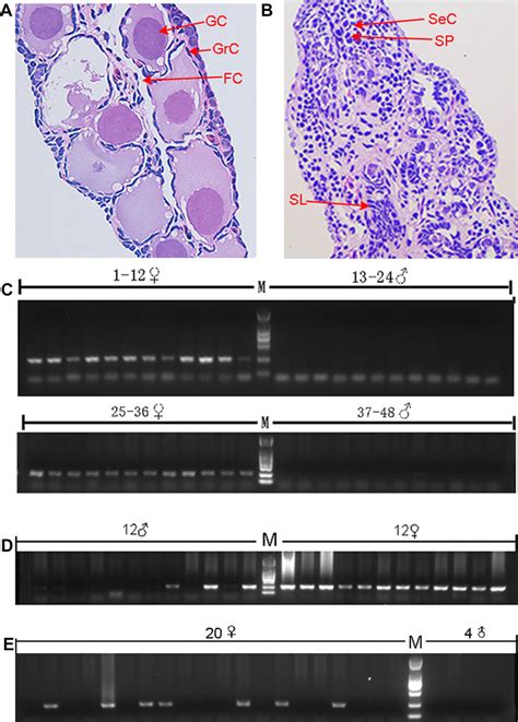 Identification Of Physiological Sex And Genetic Sex A Histology Download Scientific Diagram