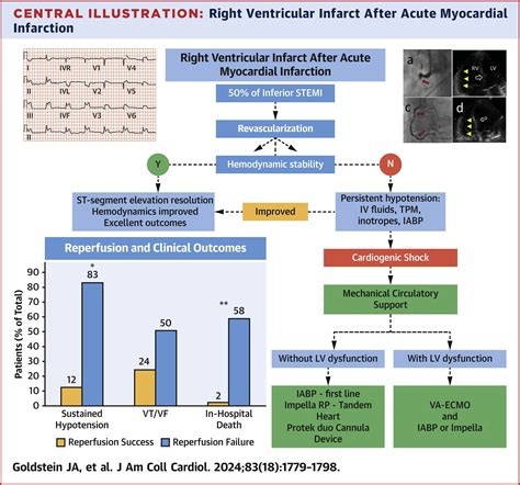 Right Ventricular Myocardial Infarction—a Tale Of Two Ventricles Jacc