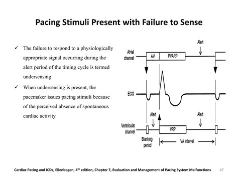 Evaluation And Management Of Pacemaker Malfunction Pptx