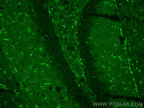 Glutamine Synthetase Antibody Cl488 66323 2 Proteintech