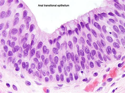 Transitional Epithelium Slide