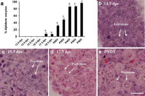 Diplotene Stage Oocytes Are First Detected At 175 Dpc A Percentage Of