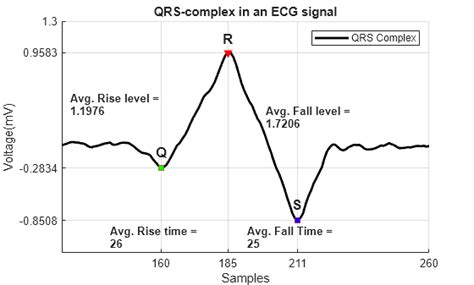 Descriptive Statistics Matlab And Simulink