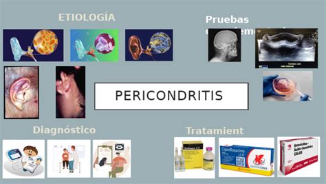 Pericondritis Pdf