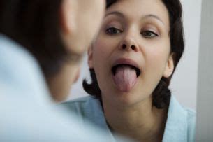 Swollen Tongue Causes And Treatment