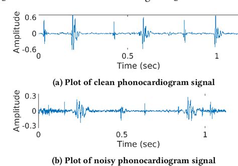 Figure 1 From A Novel U Net Architecture For Denoising Of Real World Noise Corrupted
