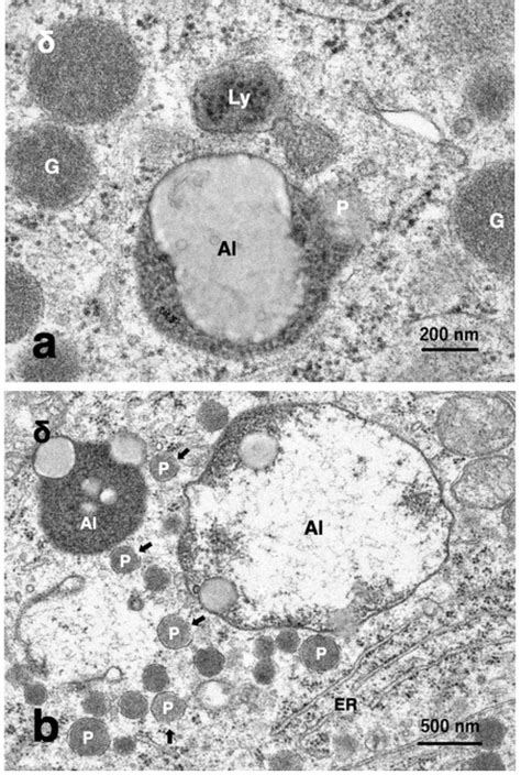 Peroxisome Electron Micrograph