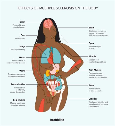 What Causes Multiple Sclerosis Ms Gut Health Jo