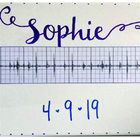Sample Artwork Surrounding Sample Cardiac Phonocardiogram Download Scientific Diagram
