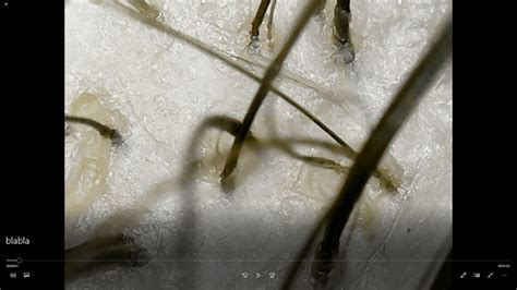 Scalp Build Up R Dailywash