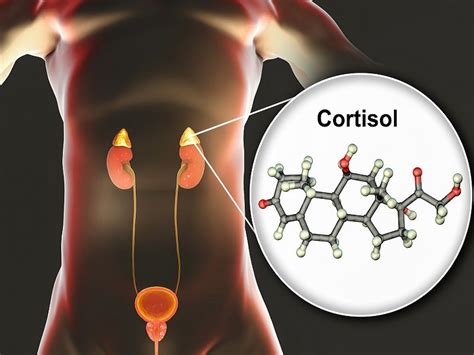 Isturisa® Osilodrostat For The Treatment Of Cushings Disease
