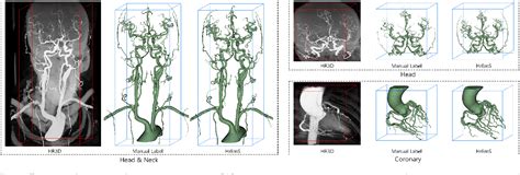 Figure 1 From An Energy Matching Vessel Segmentation Framework In 3 D Medical Images Semantic