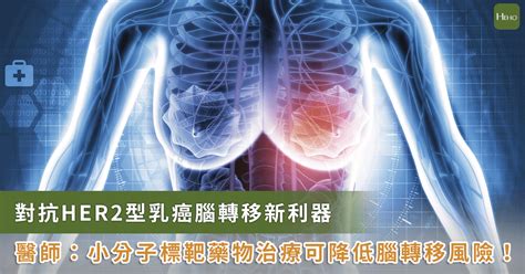 解決大分子用藥難題小分子標靶藥物預防腦轉移 早期HER2陽性乳癌可治癒 Heho Cancer