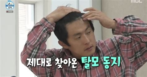 기안84 탈모로 모발이식 고백 3대째 대머리 내가 끊어”나혼산 결정적장면