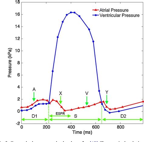 Figure 3 From Mitral Valve Dynamics In Structural And Fluidstructure Interaction Models